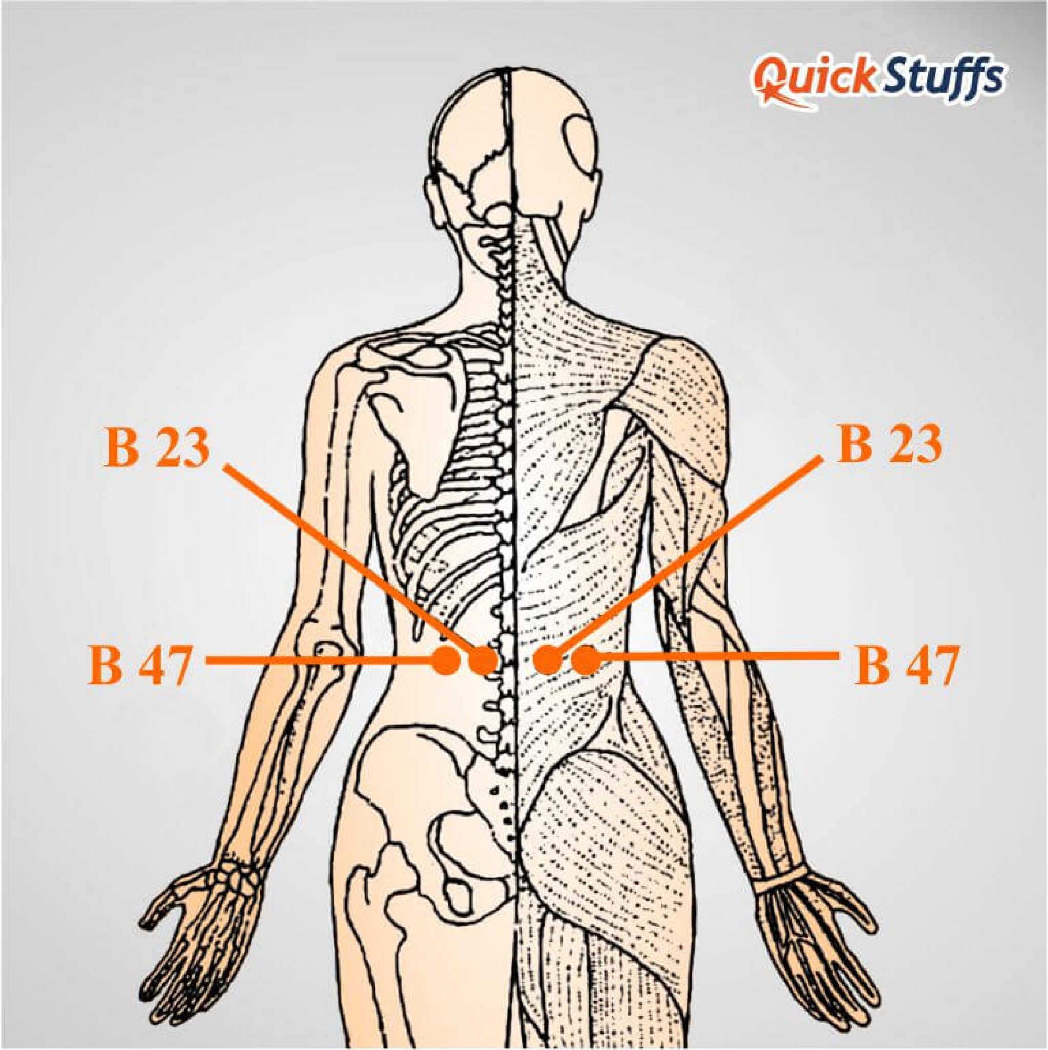 Acupuncture for Sciatica: Can it Cure your Back Pain?